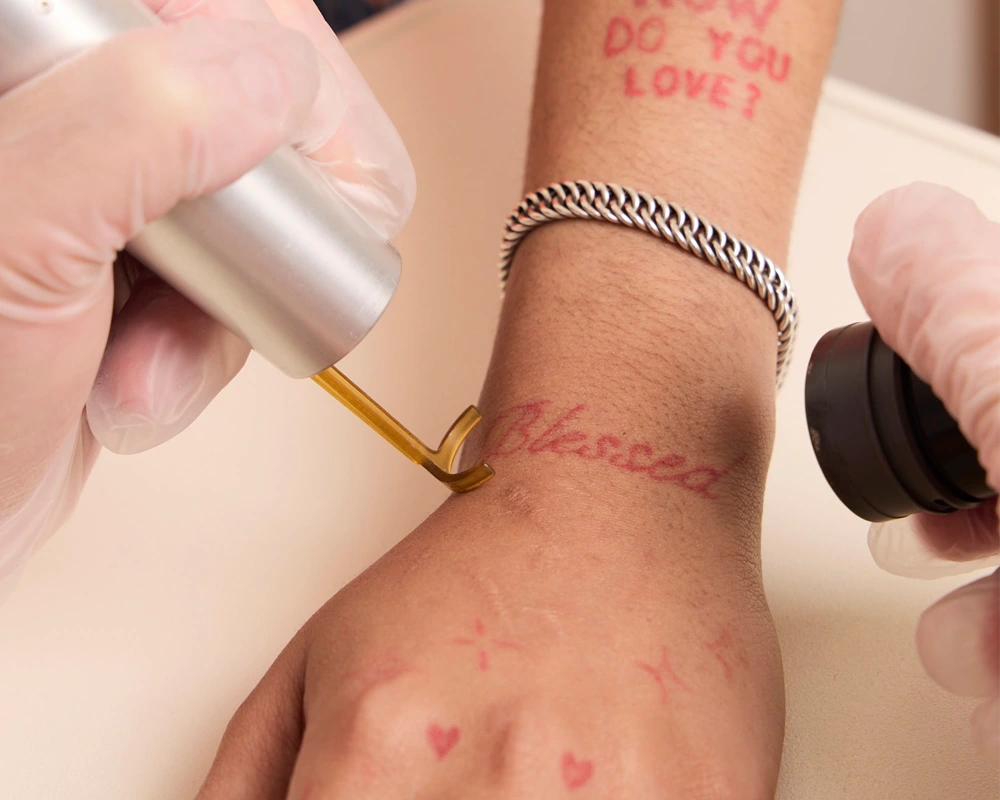 Ray studios - Centro de Eliminación de Tatuajes